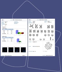ASI Technology - ASI - Applied Spectral Imaging